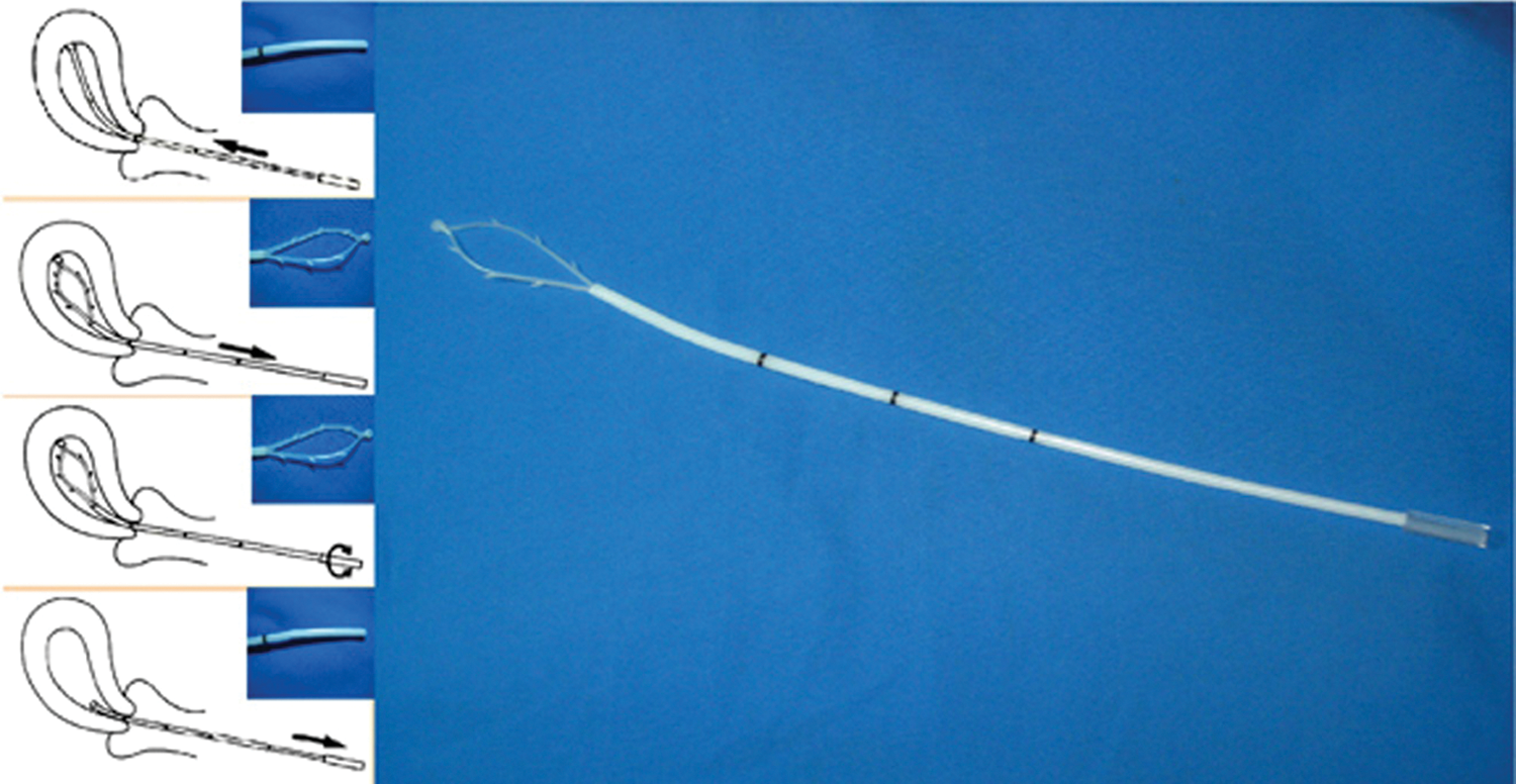 Immunocytochemical examination of PTEN and Ki-67 for endometrial ...