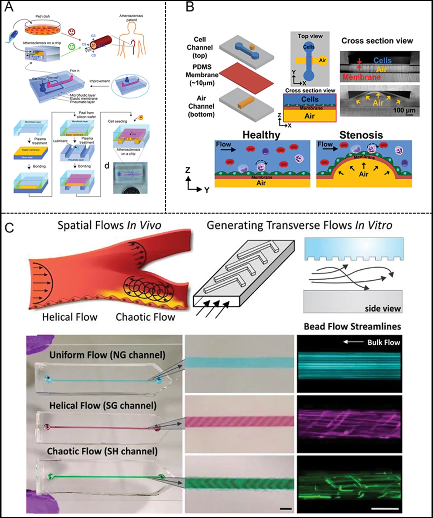 Microfluidic chips for the endothelial biomechanics and mechanobiology ...
