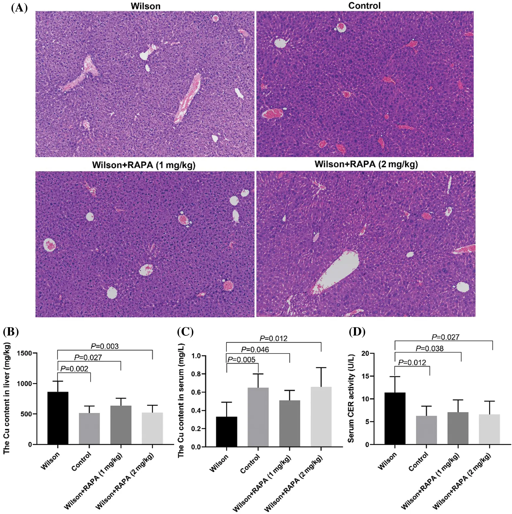The role of mTOR signaling pathway in regulating autophagy in liver ...
