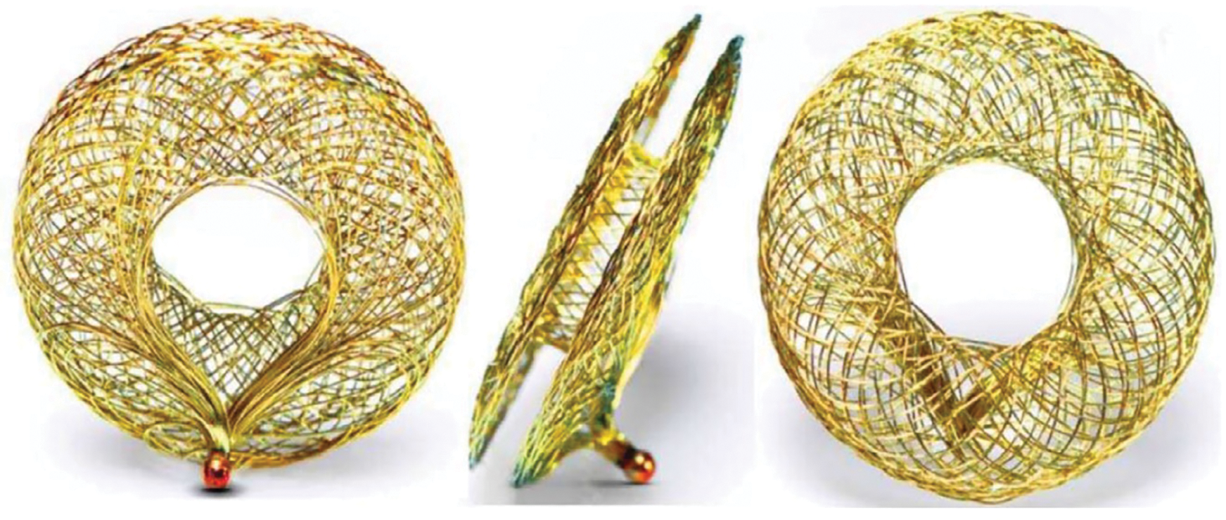 Mid-Term Preliminary Results for Safety and Patency of the Occlutech ...