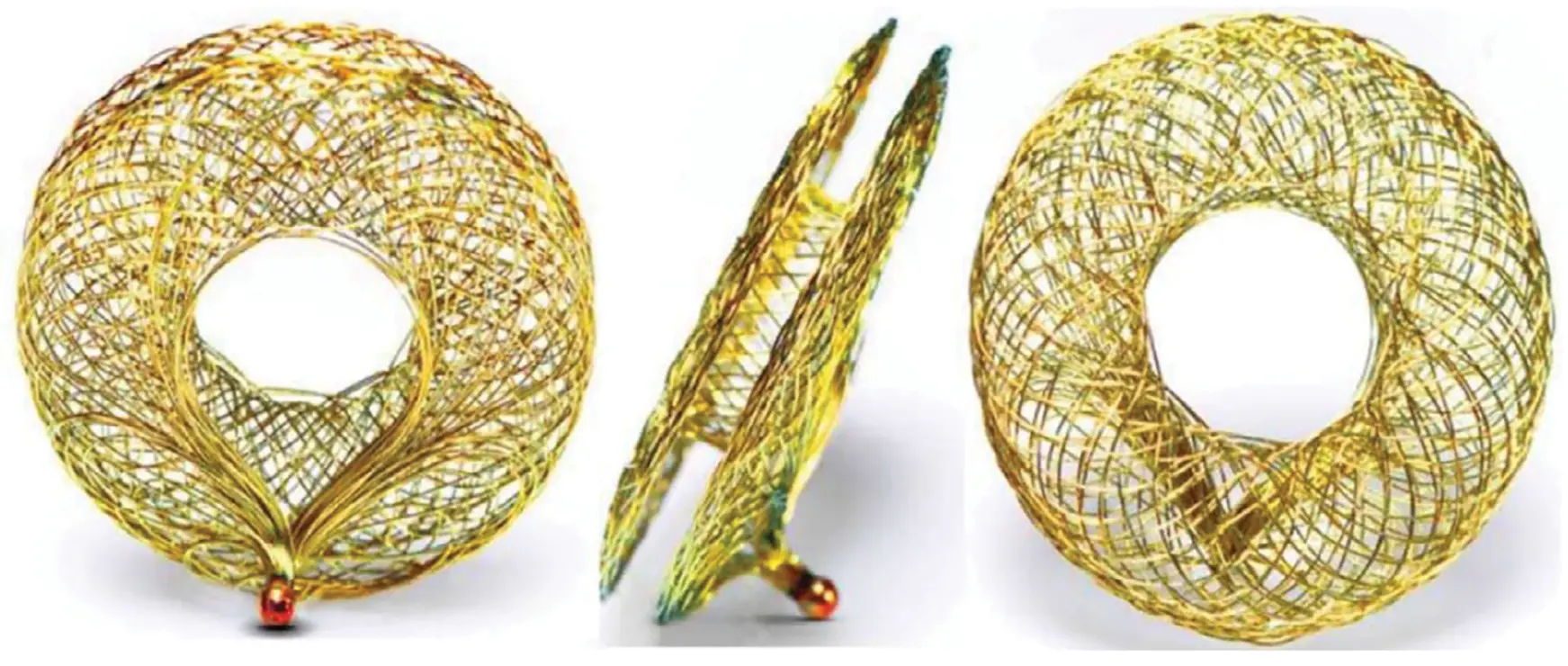 Mid-Term Preliminary Results for Safety and Patency of the Occlutech ...