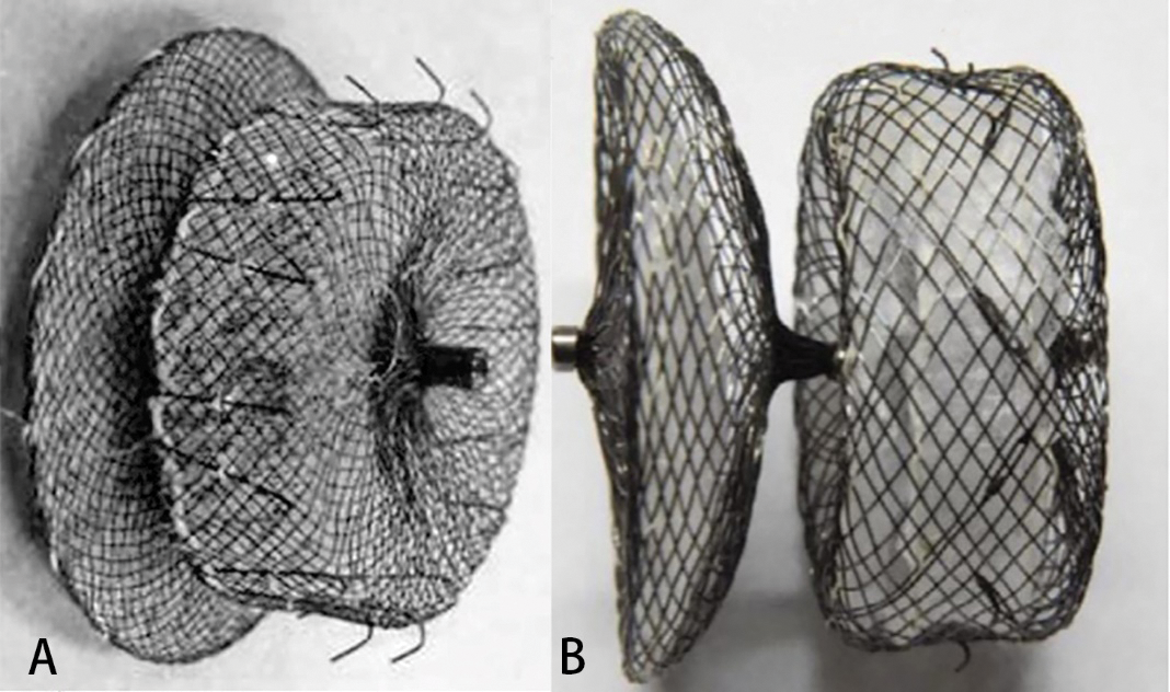 Simultaneous Transcatheter Closure of the Left Atrial Appendage and ...