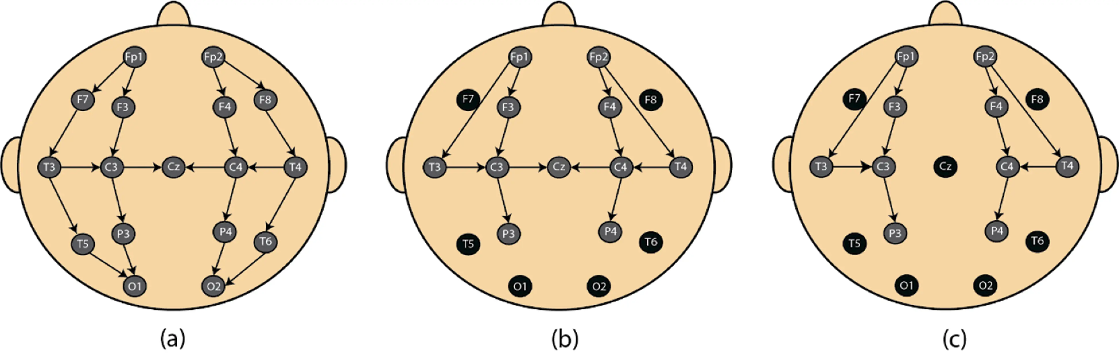 EEG-Based Neonatal Sleep Stage Classification Using Ensemble Learning