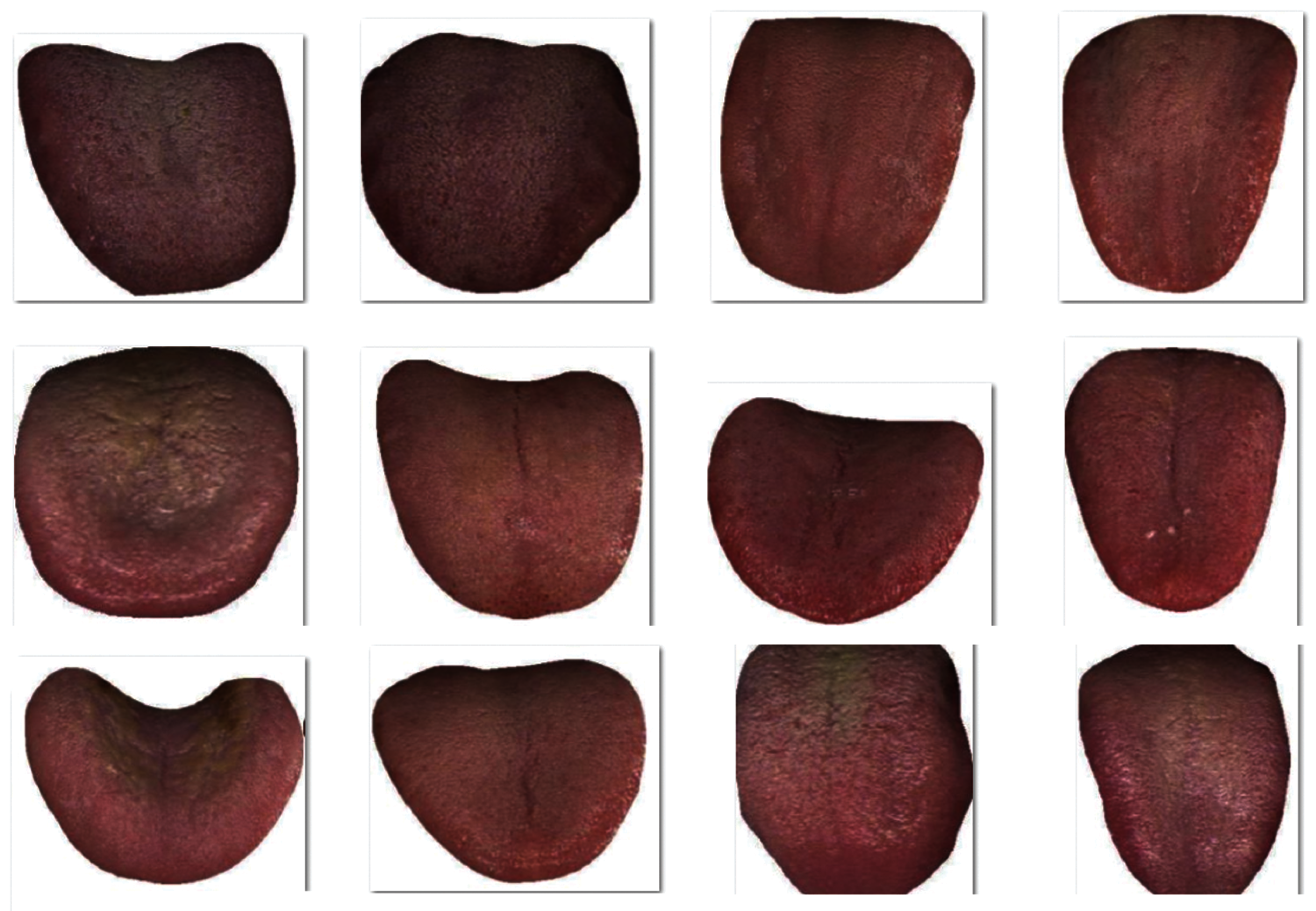 Intelligent Deep Learning Based Disease Diagnosis Using Biomedical ...