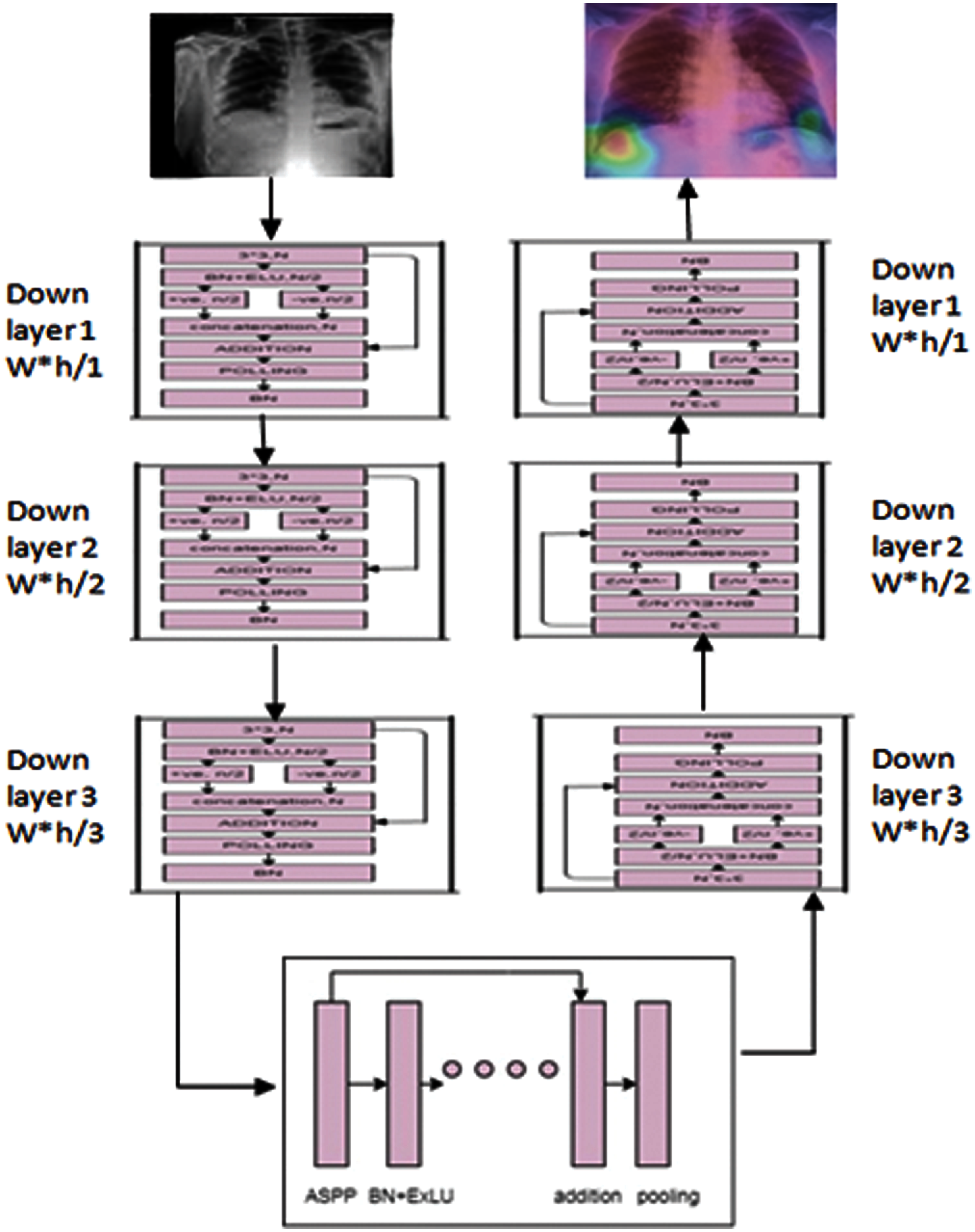 Kernel Granulometric Texture Analysis and Light RES-ASPP-UNET ...