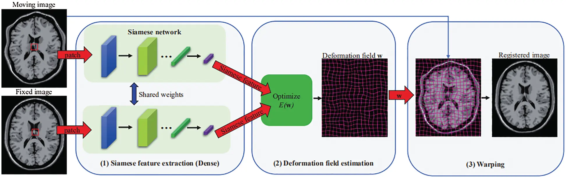 Optical Flow with Learning Feature for Deformable Medical Image ...