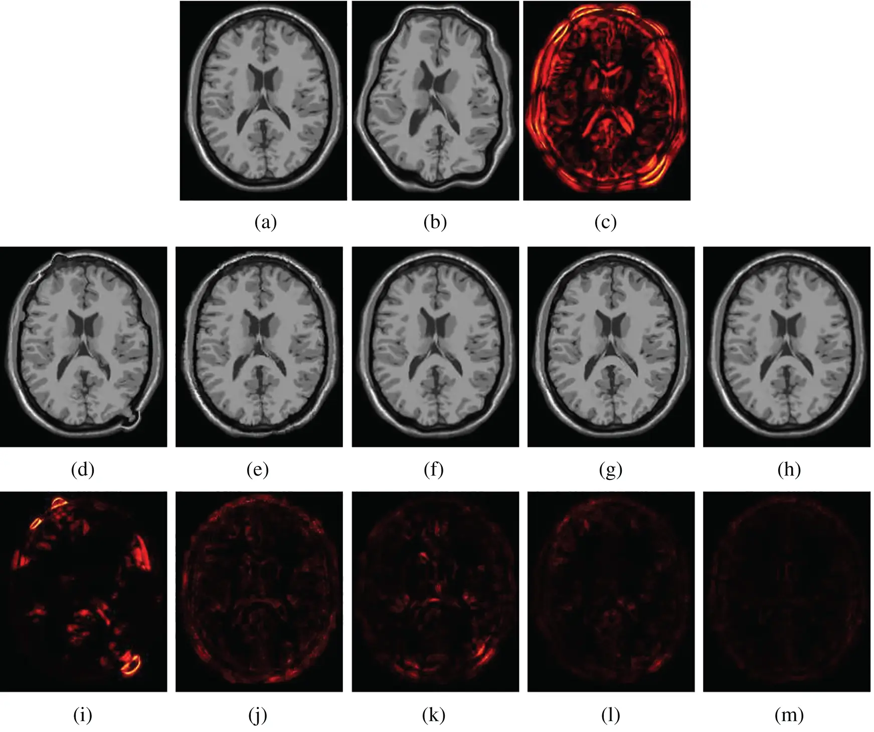 Optical Flow with Learning Feature for Deformable Medical Image ...
