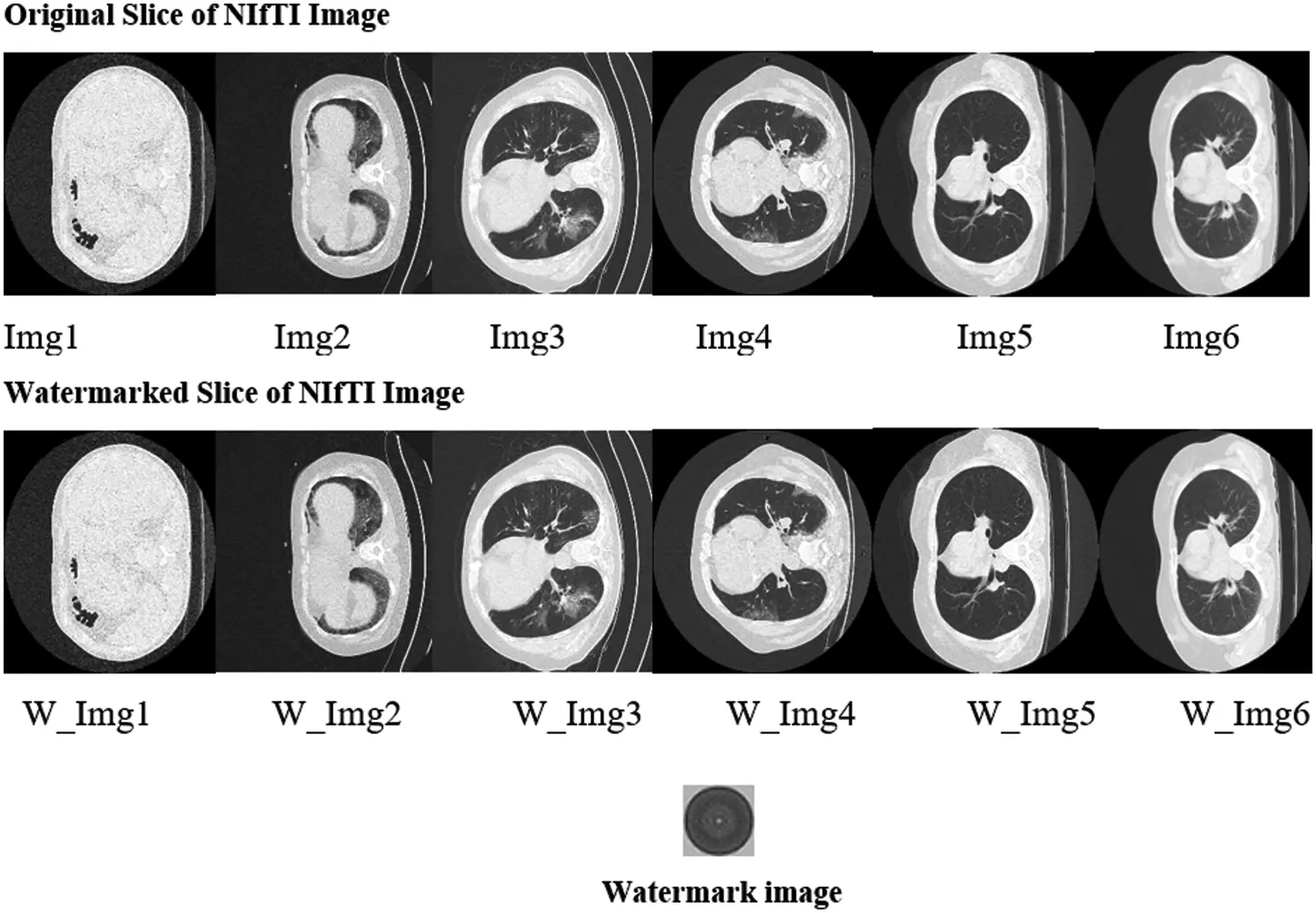 Robust Watermarking Scheme for NIfTI Medical Images