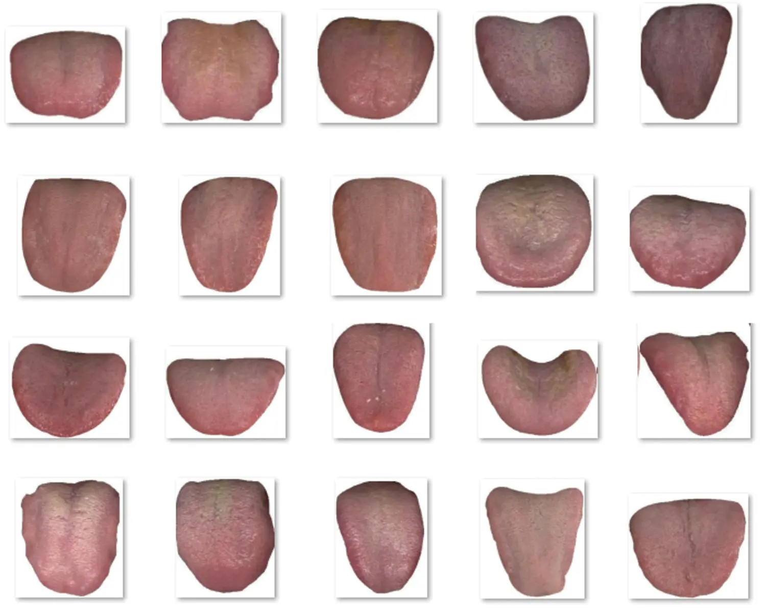 Fusion Based Tongue Color Image Analysis Model for Biomedical Applications