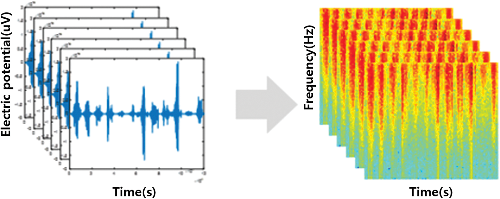 User Recognition System Based on Spectrogram Image Conversion Using EMG Signals