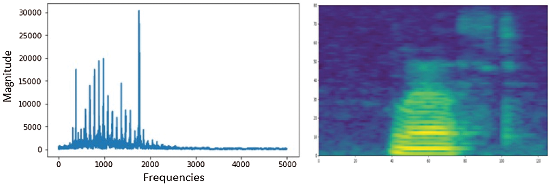 An Innovative Approach Utilizing Binary-View Transformer for Speech Recognition Task