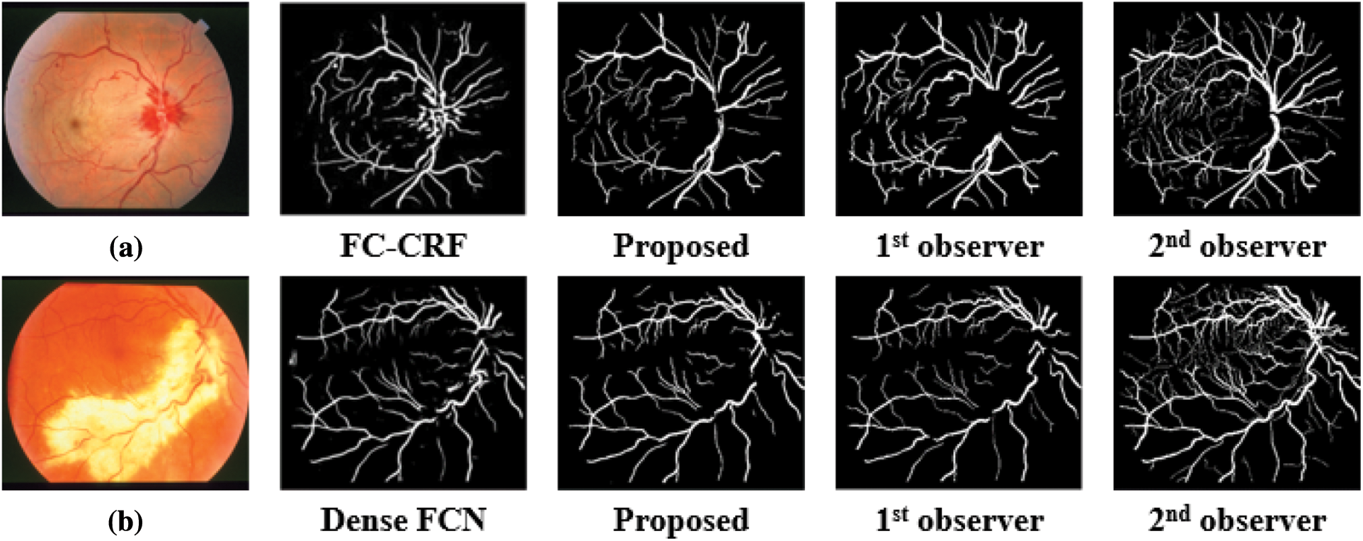 Modified Anam-Net Based Lightweight Deep Learning Model for Retinal ...