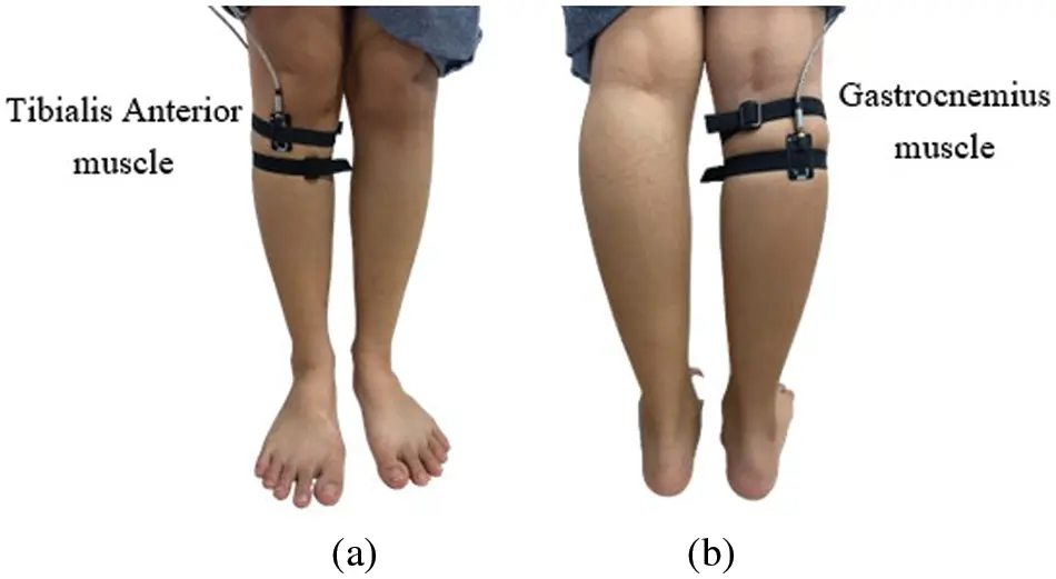 Lower-Limb Motion-Based Ankle-Foot Movement Classification Using 2D-CNN