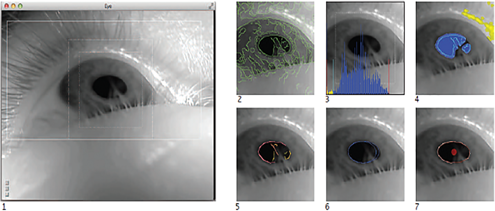 Robust and High Accuracy Algorithm for Detection of Pupil Images