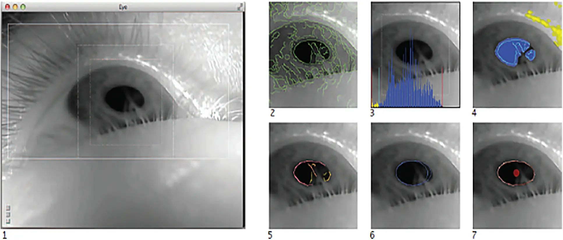 Robust and High Accuracy Algorithm for Detection of Pupil Images