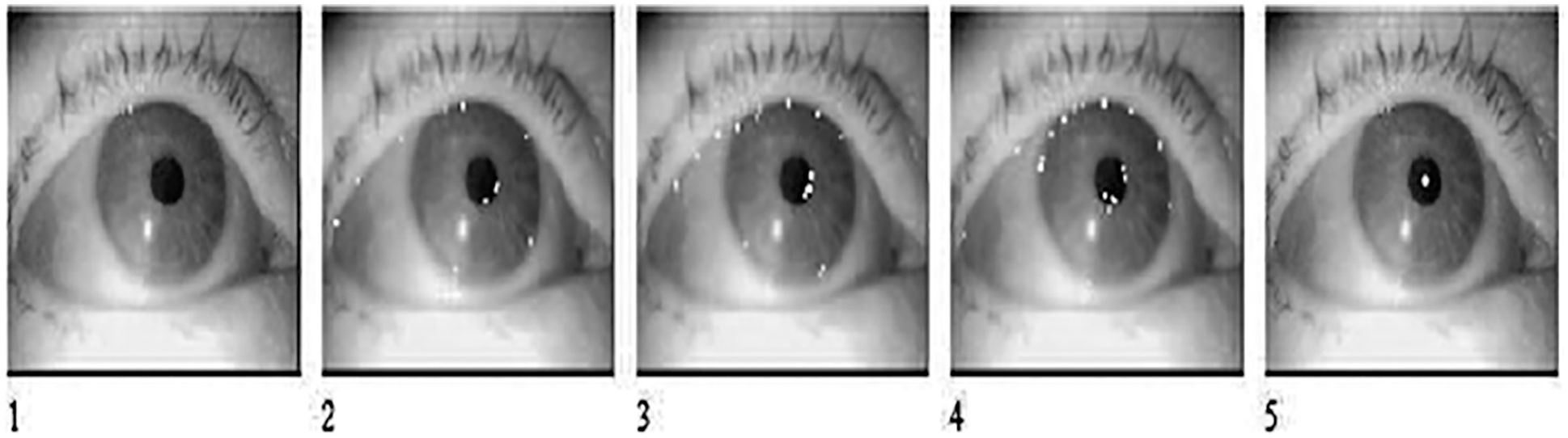 Robust and High Accuracy Algorithm for Detection of Pupil Images