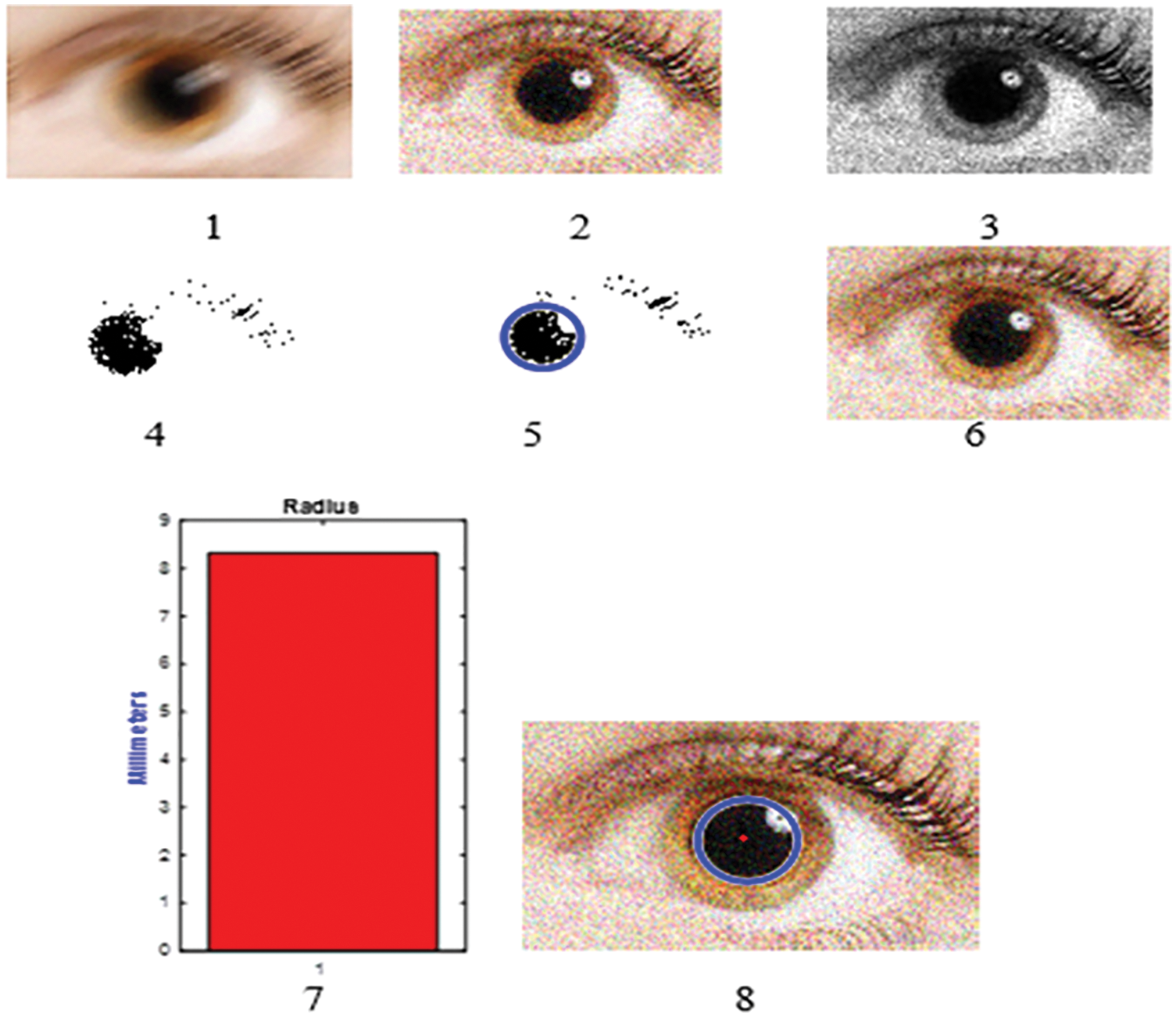 Robust and High Accuracy Algorithm for Detection of Pupil Images