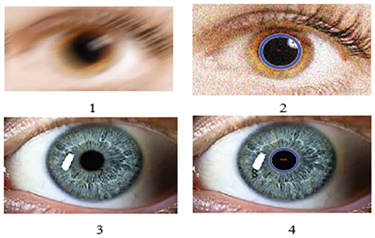 Robust and High Accuracy Algorithm for Detection of Pupil Images