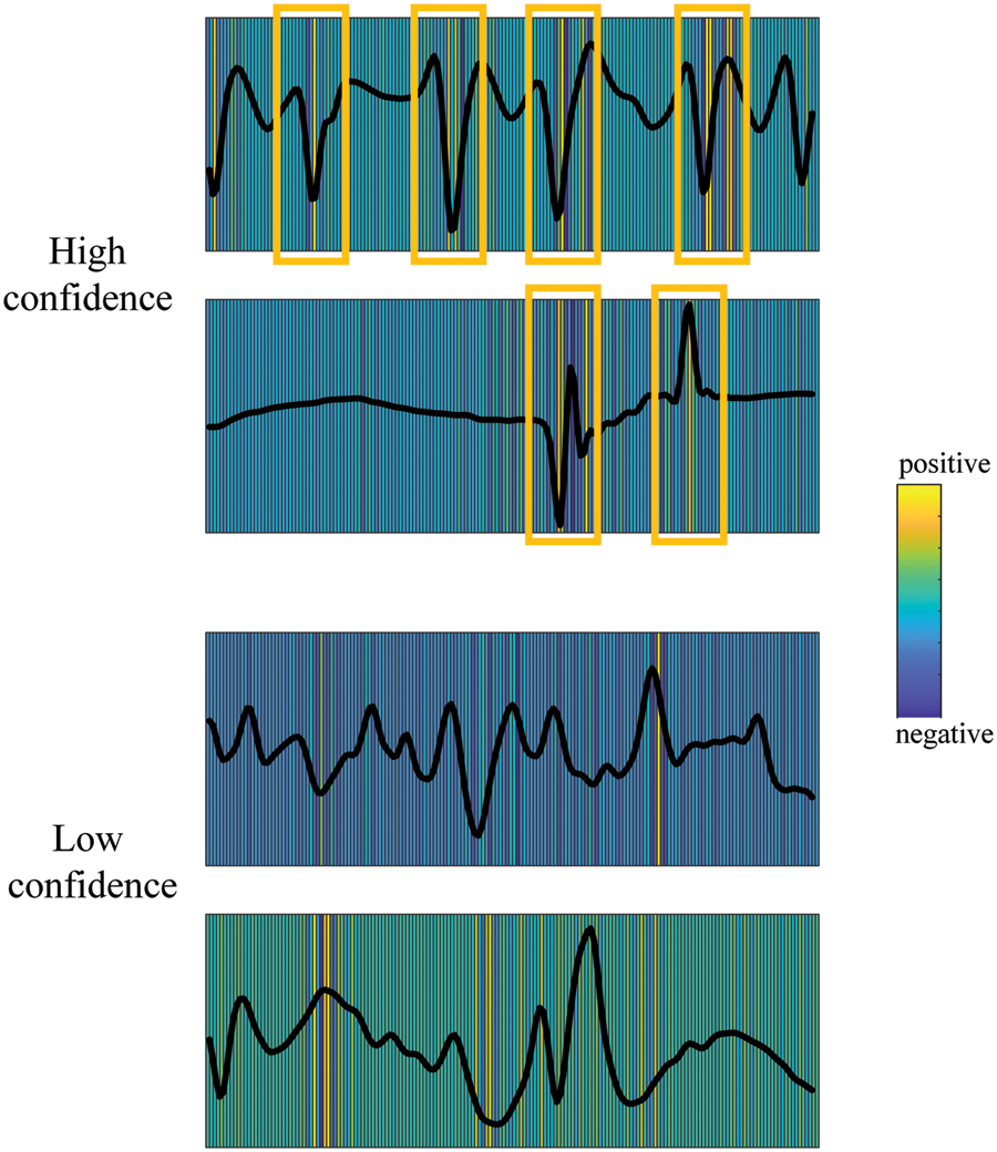 Automated Machine Learning for Epileptic Seizure Detection Based on EEG Signals