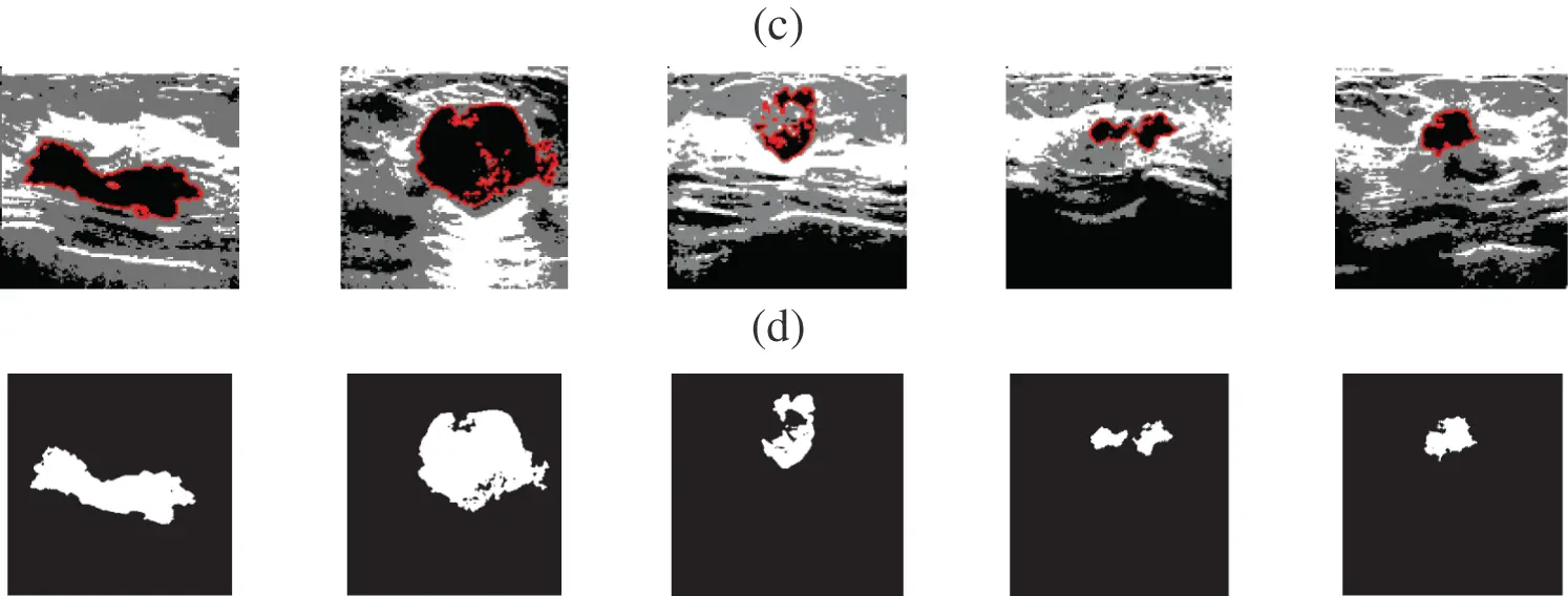 Efficient Segmentation Approach for Different Medical Image Modalities