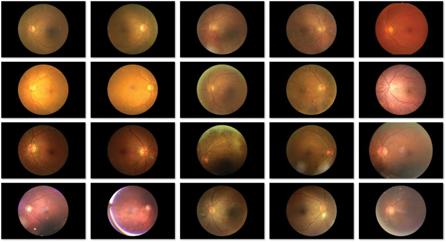 Intelligent Deep Learning Based Multi-Retinal Disease Diagnosis and ...