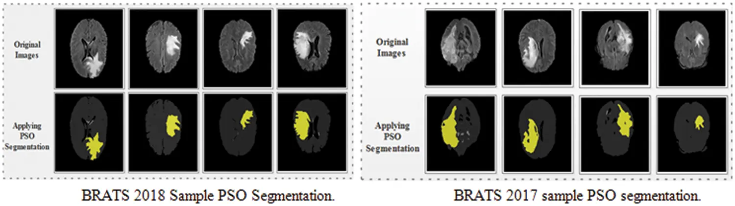Brain Tumor Detection And Classification Using Pso And Convolutional