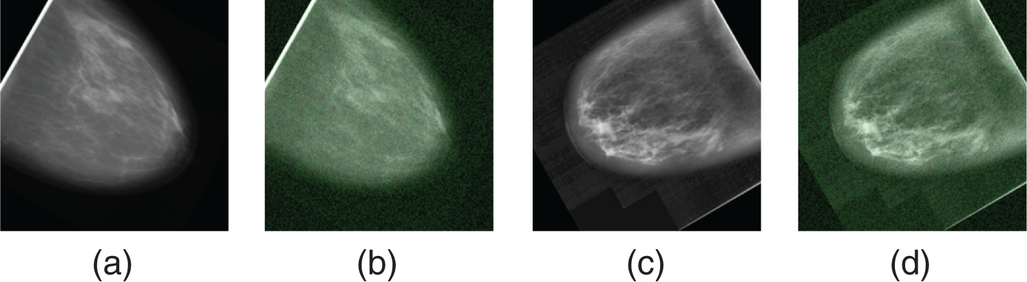 Simply Fine-Tuned Deep Learning-Based Classification for Breast Cancer ...