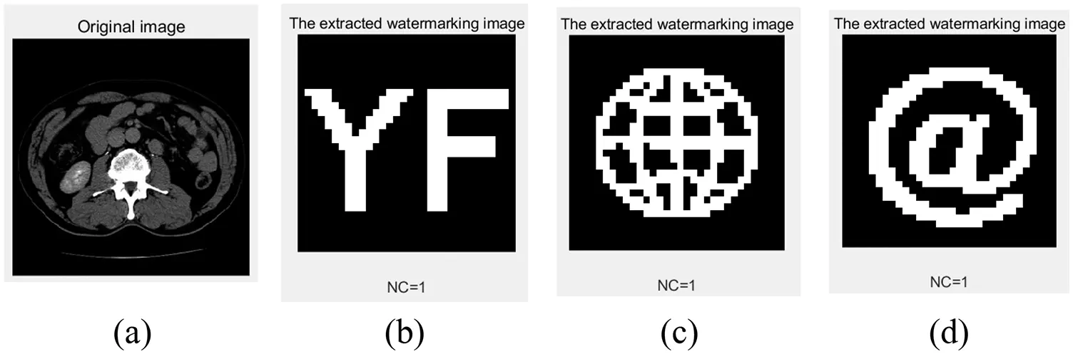 CMC | Free Full-Text | A Multi-Watermarking Algorithm for Medical ...