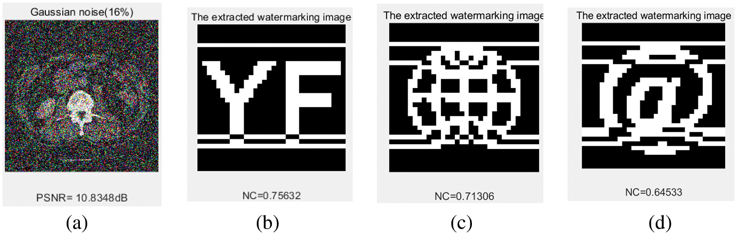 CMC | Free Full-Text | A Multi-Watermarking Algorithm for Medical ...