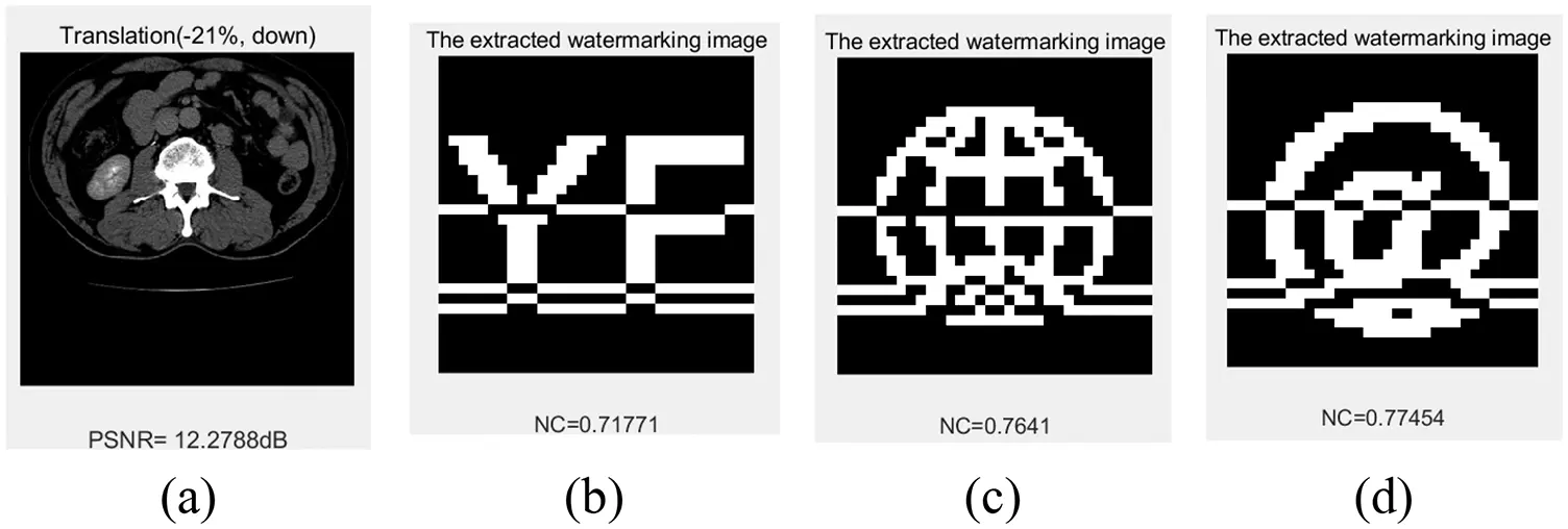 CMC | Free Full-Text | A Multi-Watermarking Algorithm for Medical ...