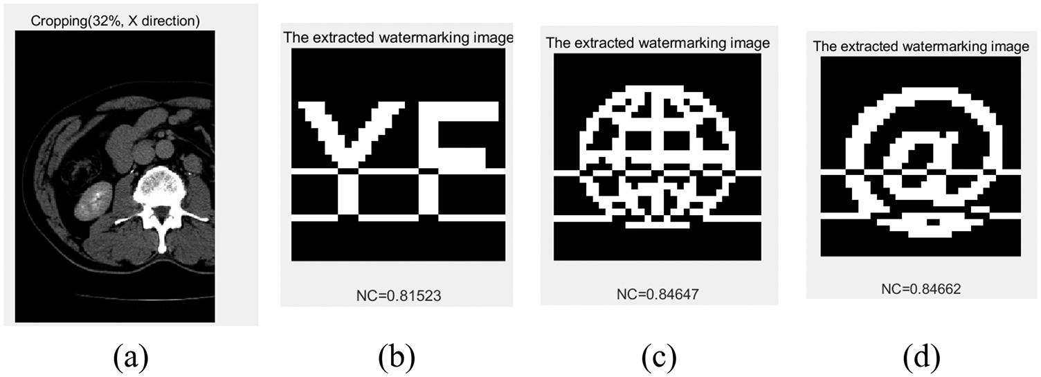 CMC | Free Full-Text | A Multi-Watermarking Algorithm for Medical ...