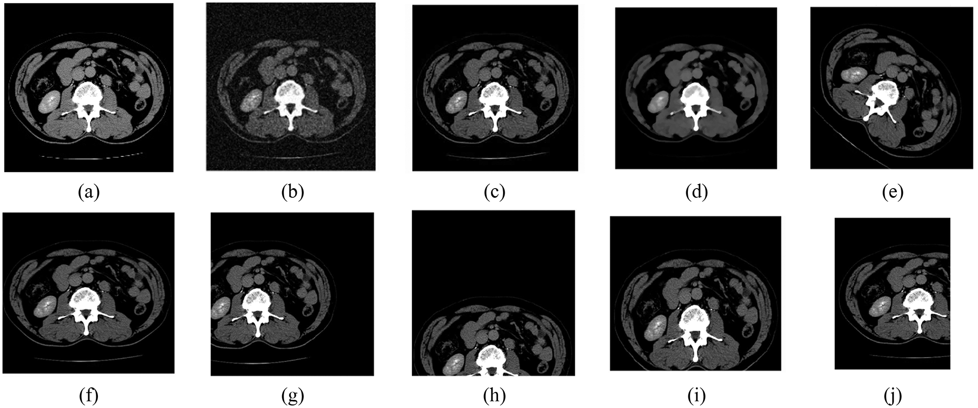 CMC | Free Full-Text | A Multi-Watermarking Algorithm for Medical ...