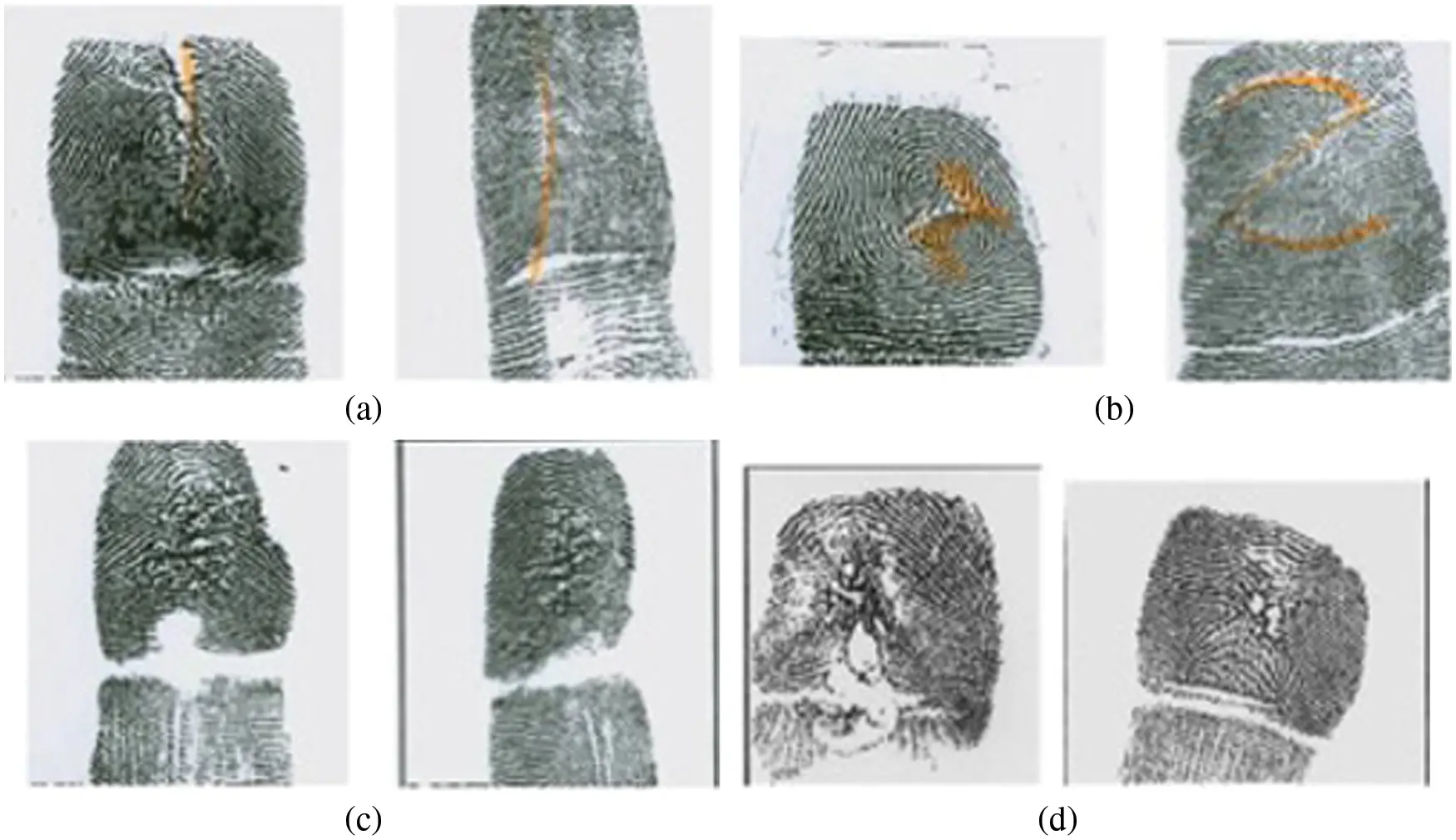 CMC | Free Full-Text | Real and Altered Fingerprint Classification ...
