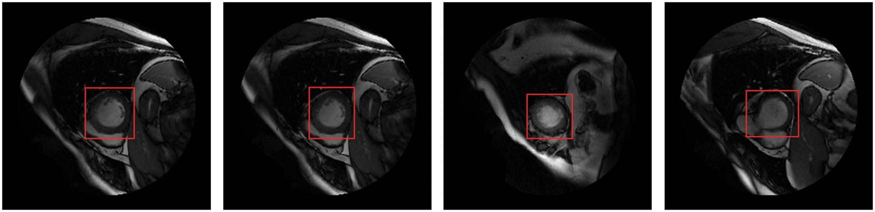 CMC | Free Full-Text | Detection of Left Ventricular Cavity from ...
