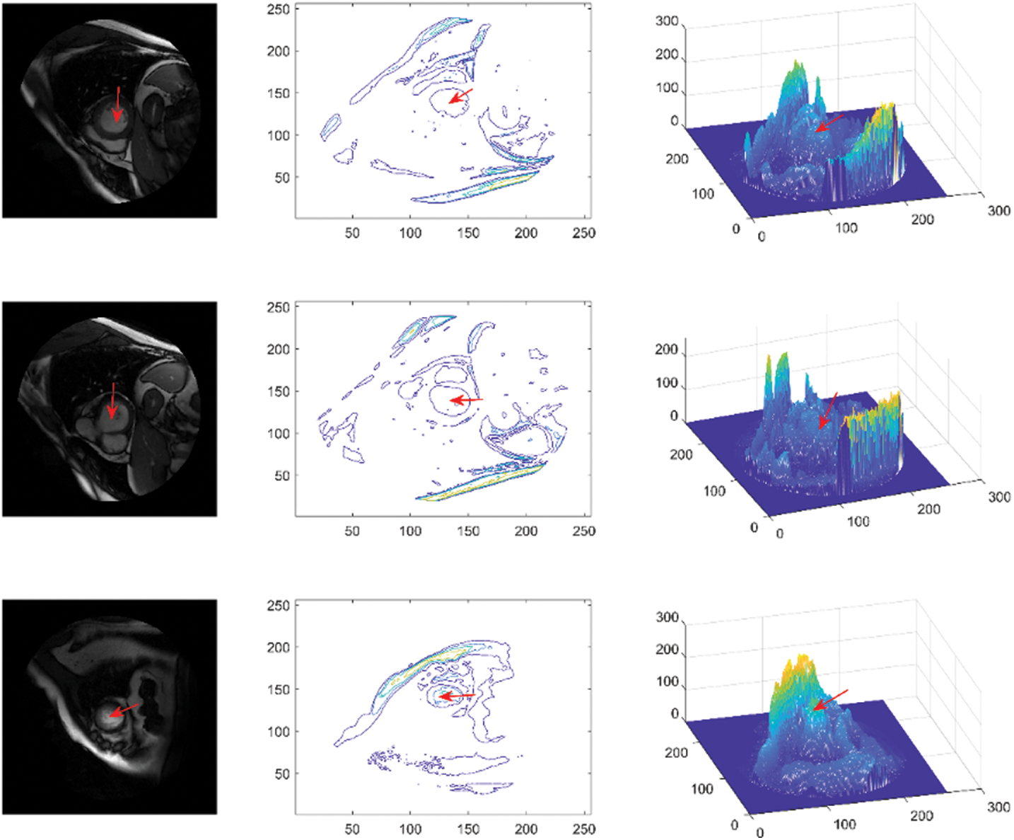 CMC | Free Full-Text | Detection of Left Ventricular Cavity from ...