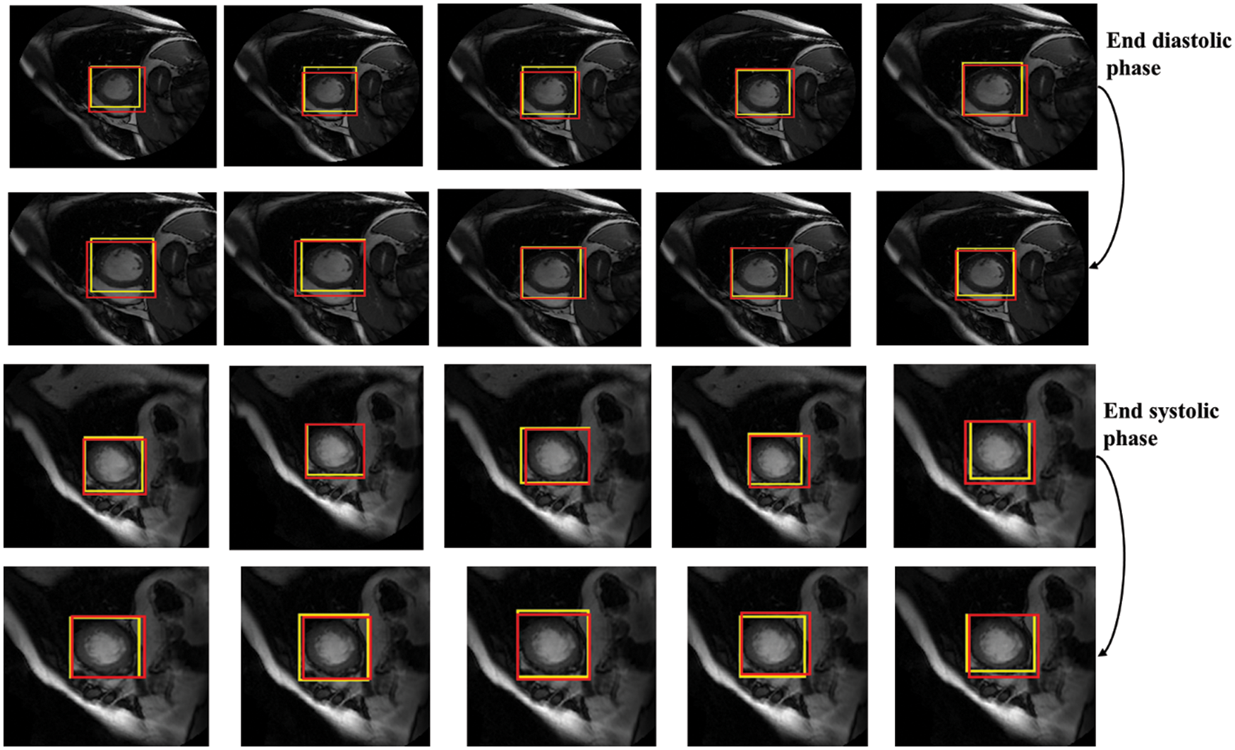 CMC | Free Full-Text | Detection of Left Ventricular Cavity from ...