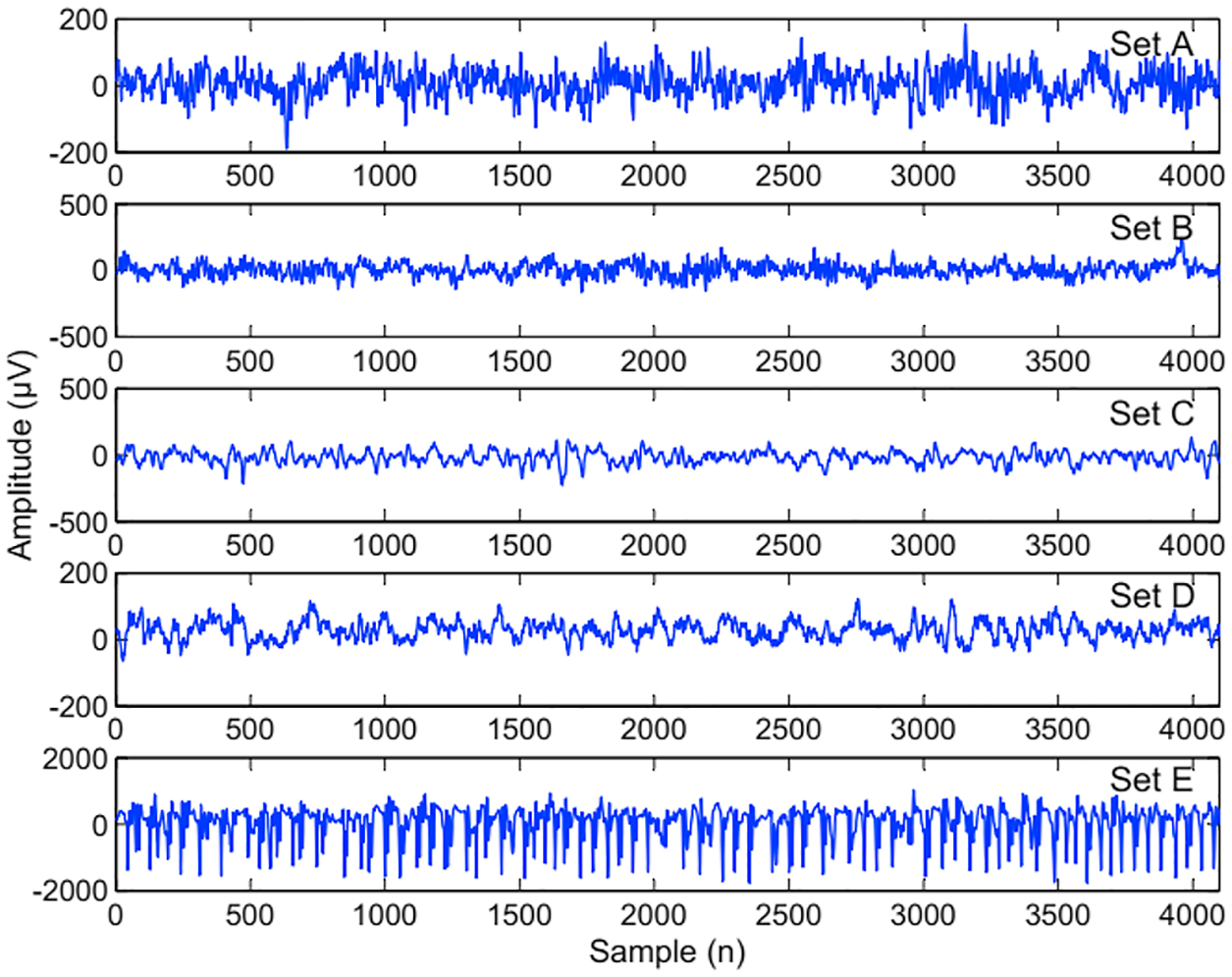 CMC | Free Full-Text | Epileptic Seizures Diagnosis Using Amalgamated ...