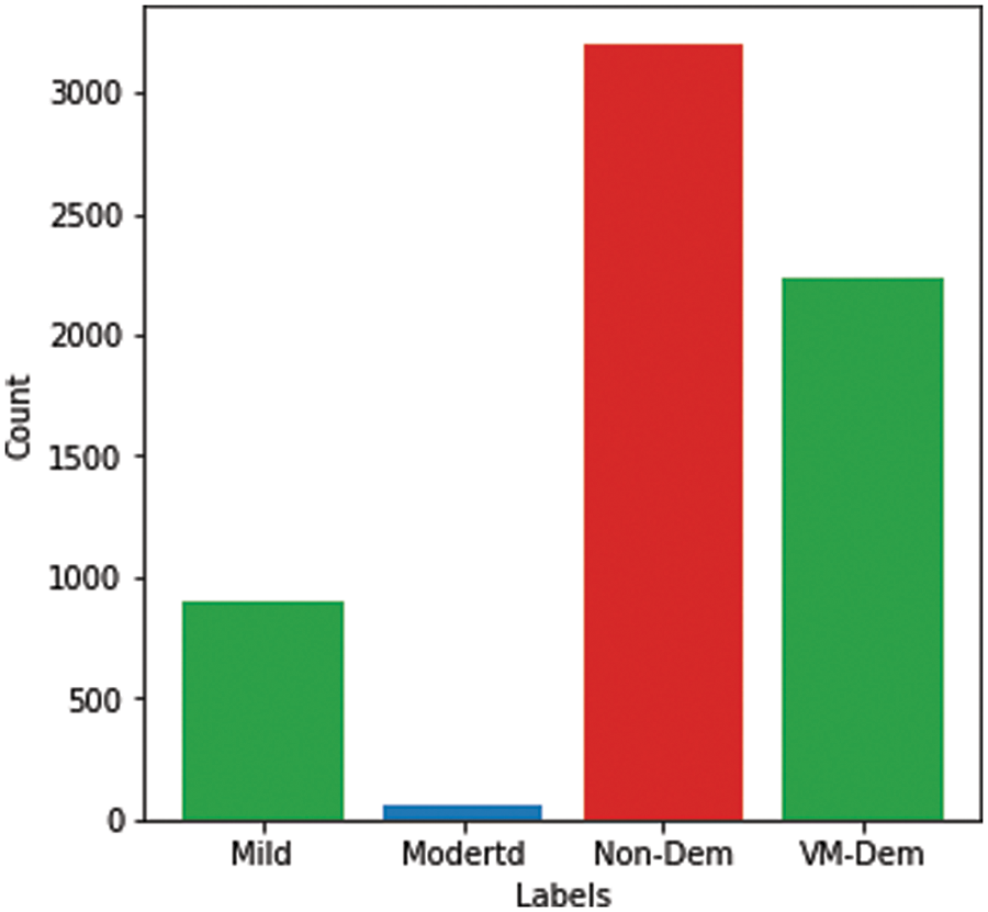 CMC | Free Full-Text | A Deep Learning for Alzheimer’s Stages Detection ...