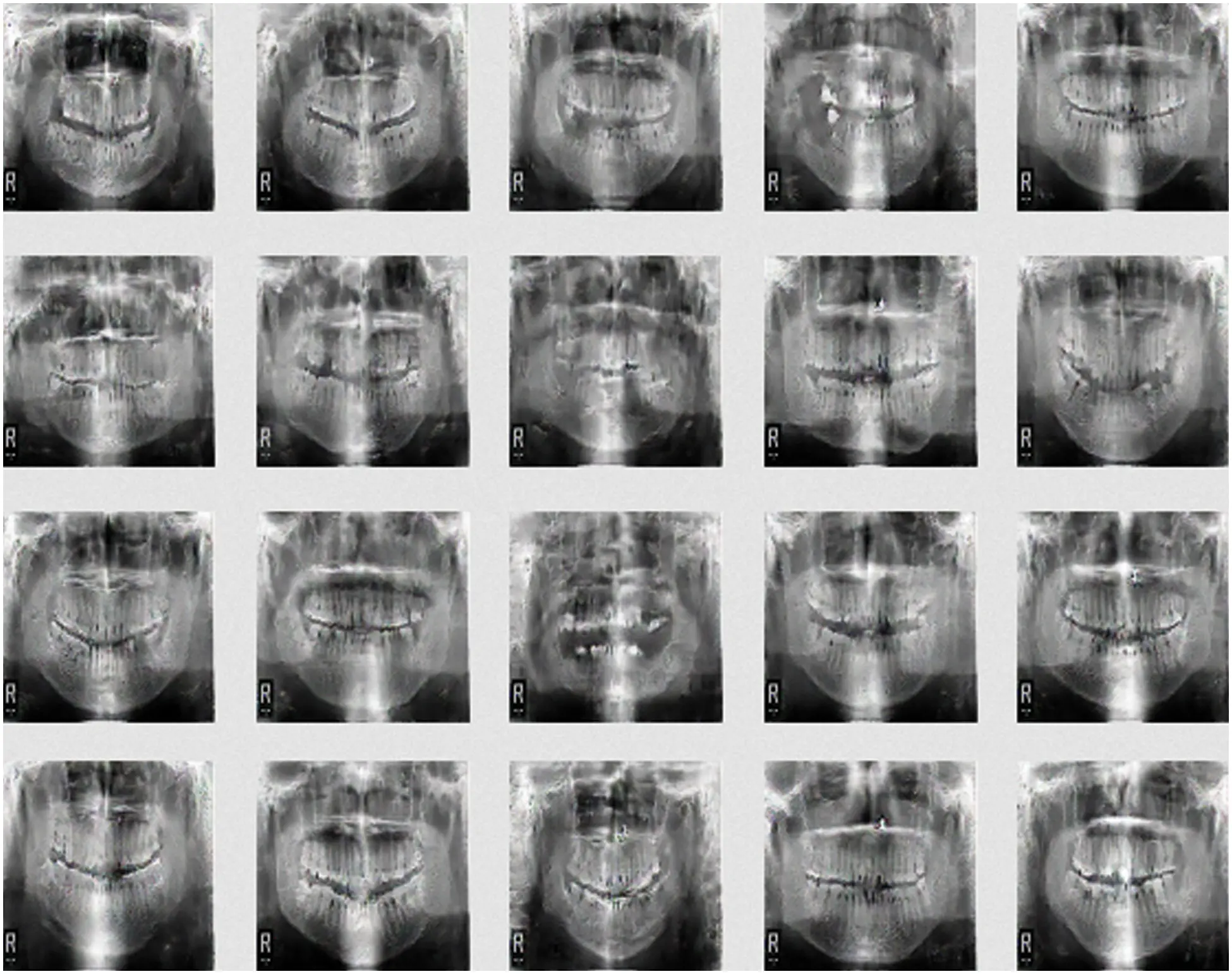 CMC | Free Full-Text | Enhancing CNN for Forensics Age Estimation Using CGAN and Pseudo-Labelling