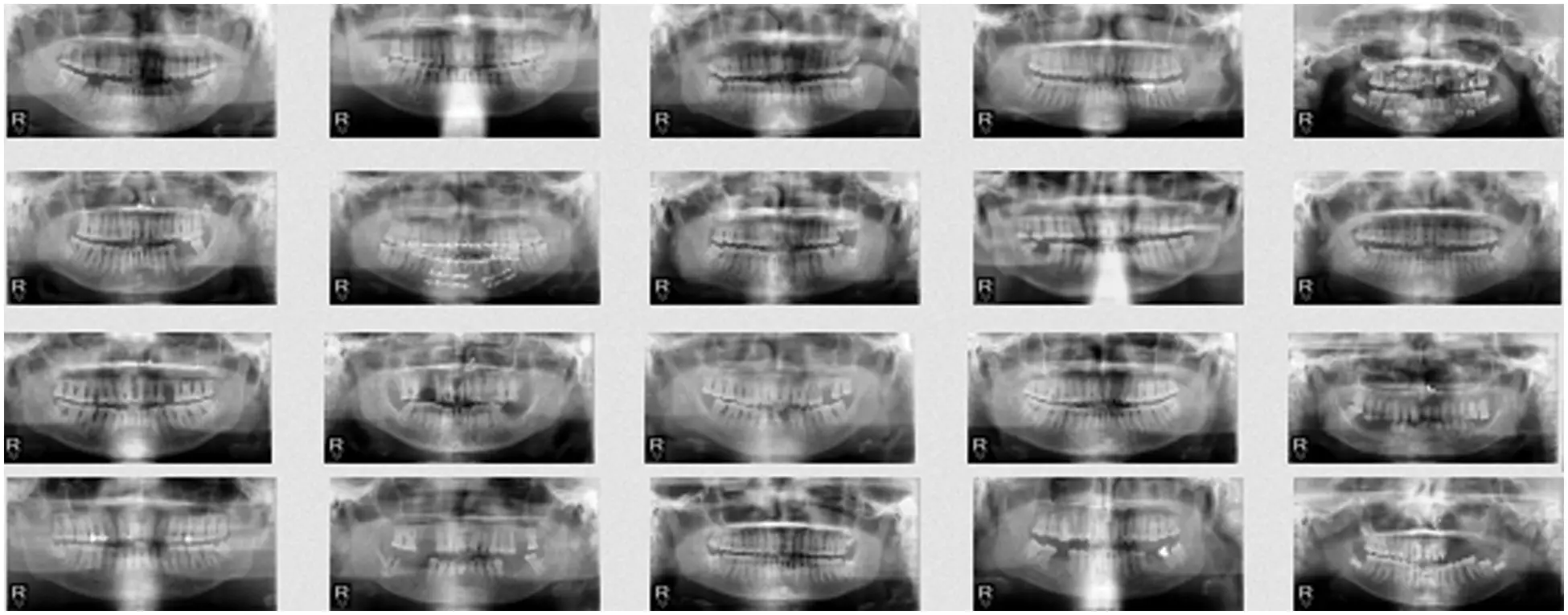 CMC | Free Full-Text | Enhancing CNN for Forensics Age Estimation Using CGAN and Pseudo-Labelling