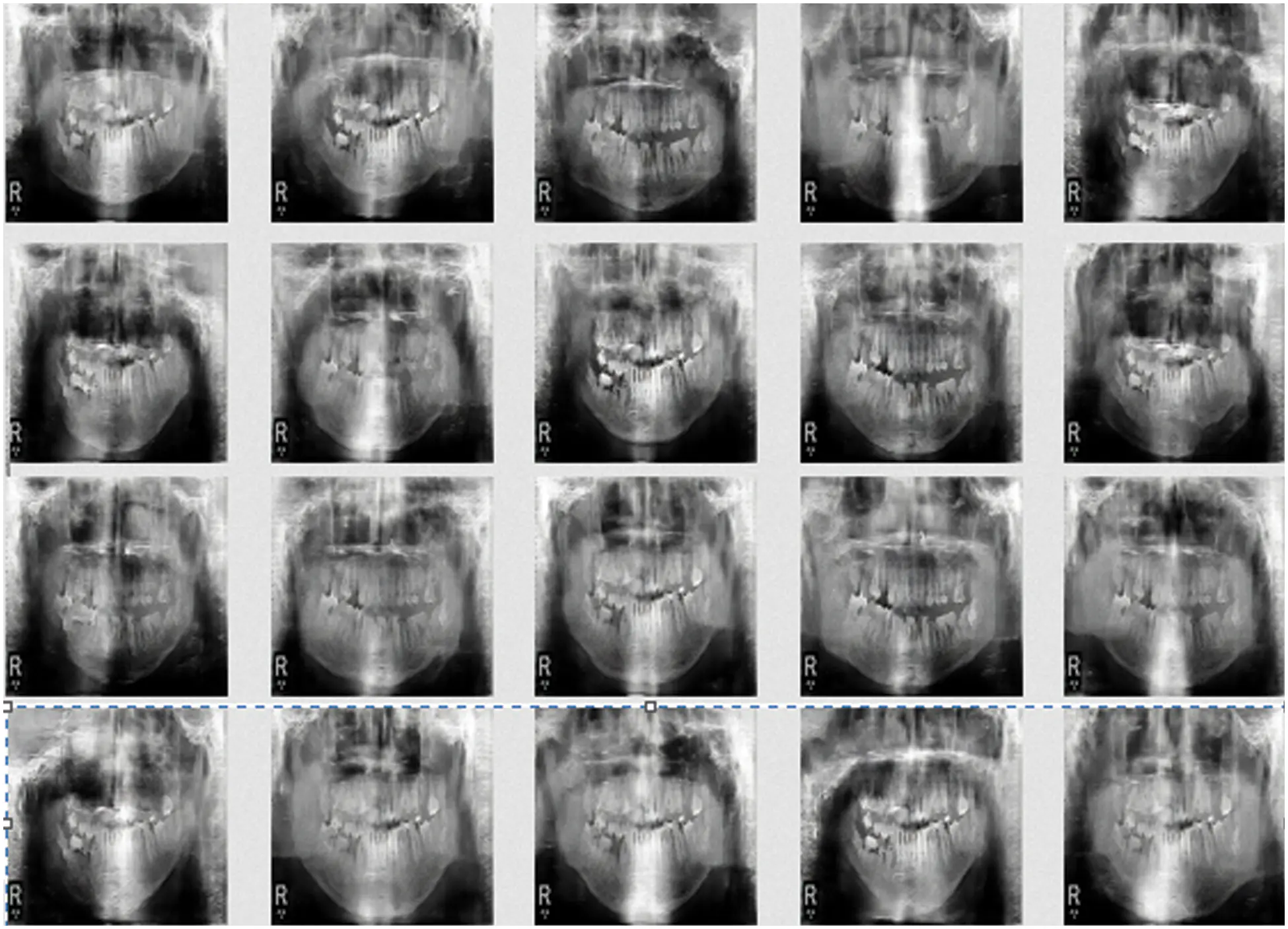 CMC | Free Full-Text | Enhancing CNN for Forensics Age Estimation Using CGAN and Pseudo-Labelling