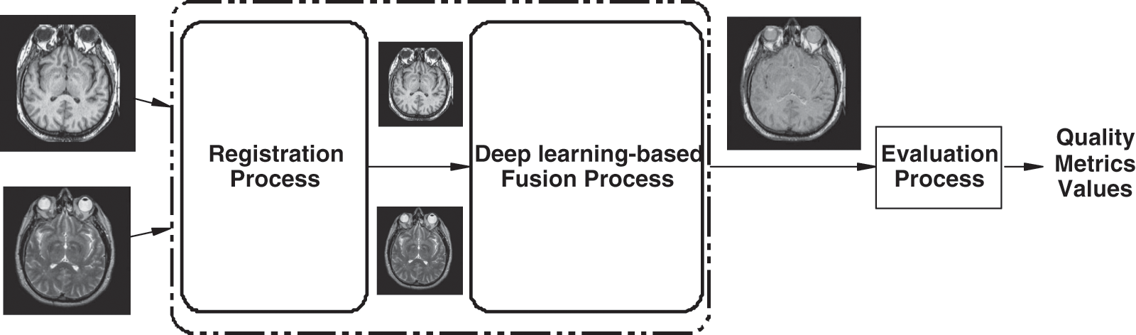 CMC | Free Full-Text | An Efficient Medical Image Deep Fusion Model ...