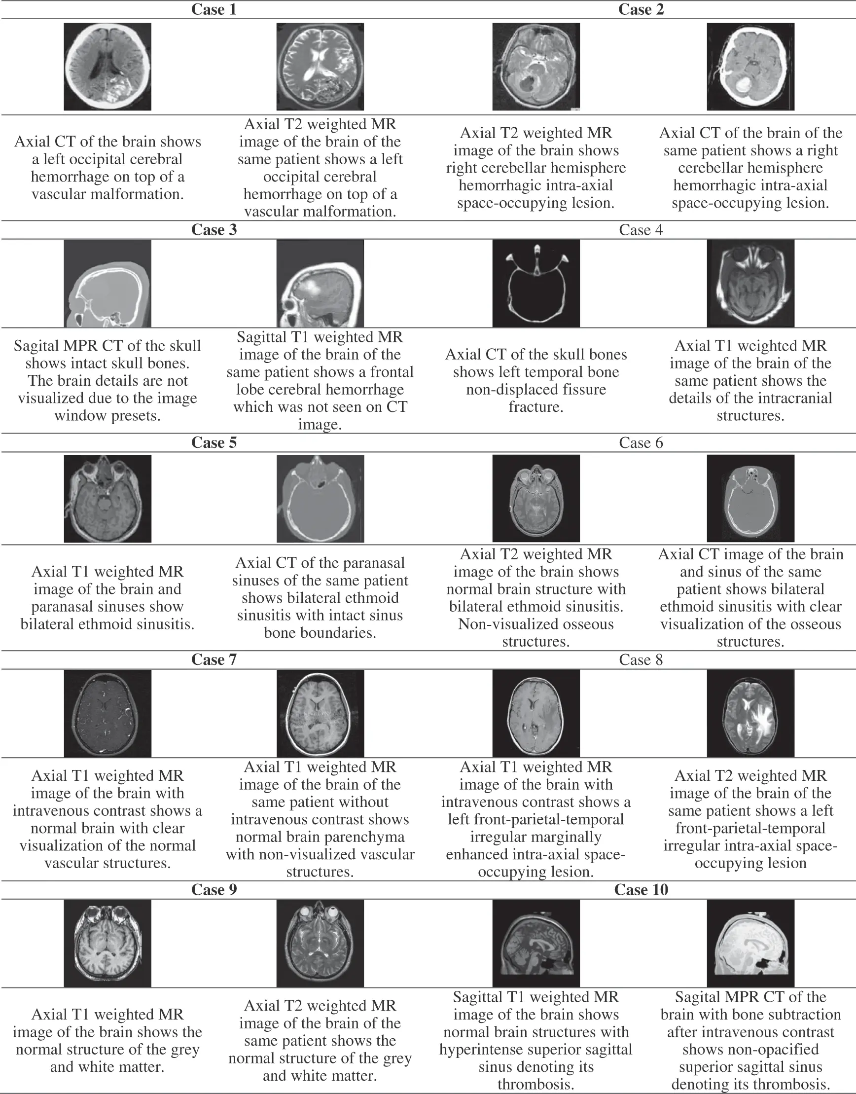 CMC | Free Full-Text | An Efficient Medical Image Deep Fusion Model ...