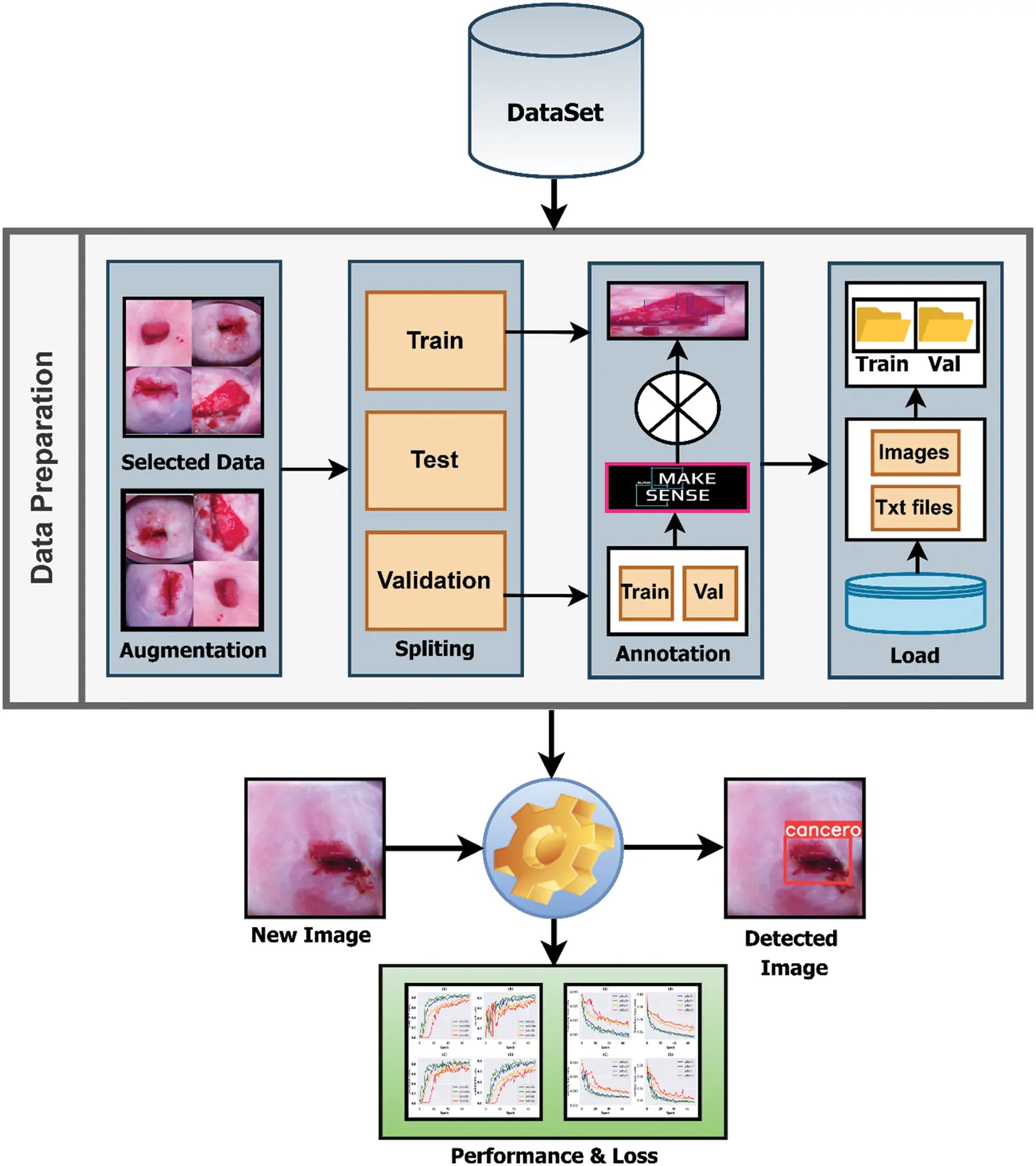 CMC | Free Full-Text | Early-Stage Cervical Cancerous Cell Detection ...
