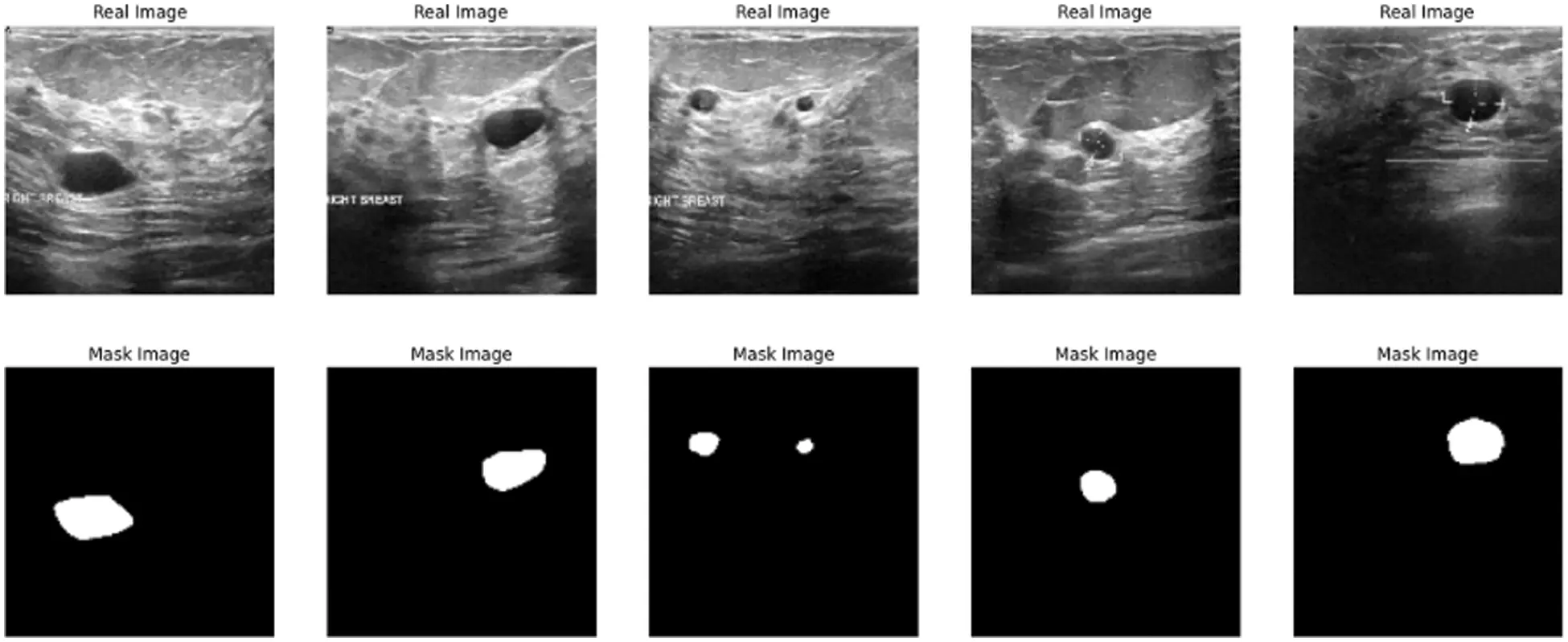 CMC | Free Full-Text | Proposed Framework for Detection of Breast Tumors