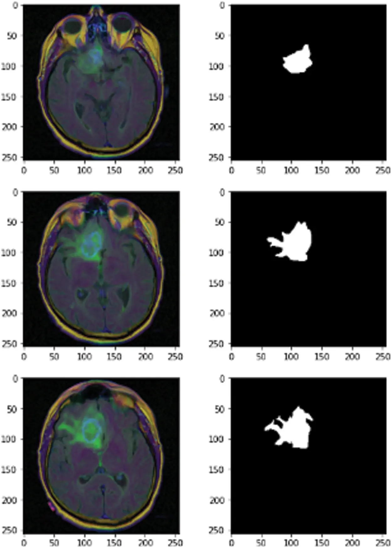 CMC | Free Full-Text | Novel Framework of Segmentation 3D MRI of Brain ...