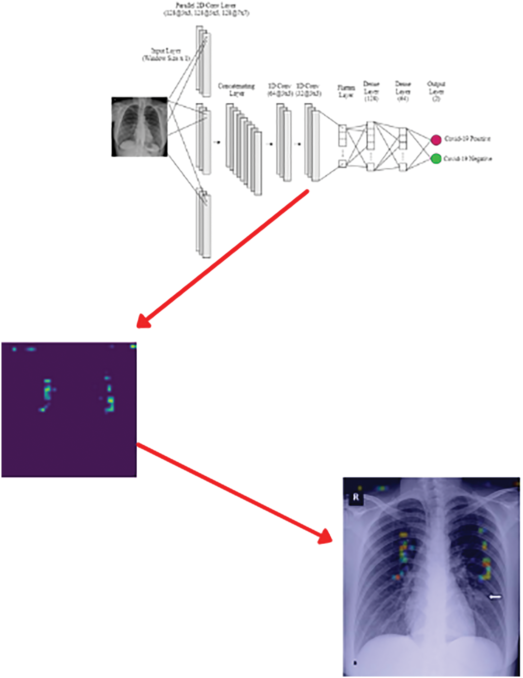 CMC | Free Full-Text | Detection of Omicron Caused Pneumonia from Radiology Images Using ...
