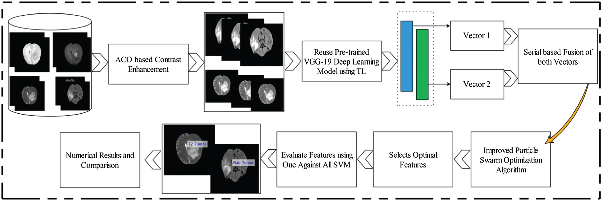 Deep Learning and Improved Particle Swarm Optimization Based Multimodal Brain Tumor Classification