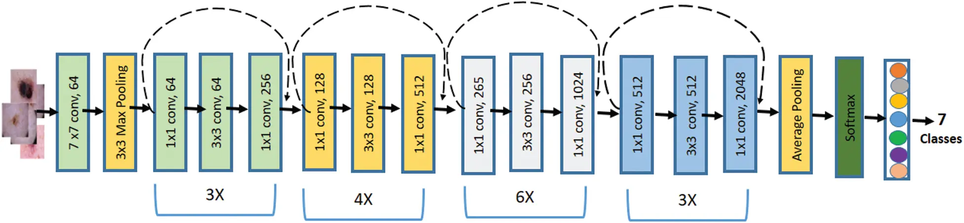 Diagnosis of Various Skin Cancer Lesions Based on Fine-Tuned ResNet50 ...