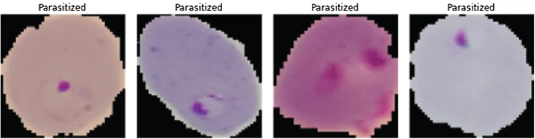 Imperative Dynamic Routing Between Capsules Network for Malaria ...